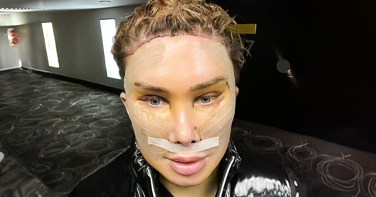 Man Who Spent £250,000 on Cosmetic Surgery to Become Barbie Regrets It ...