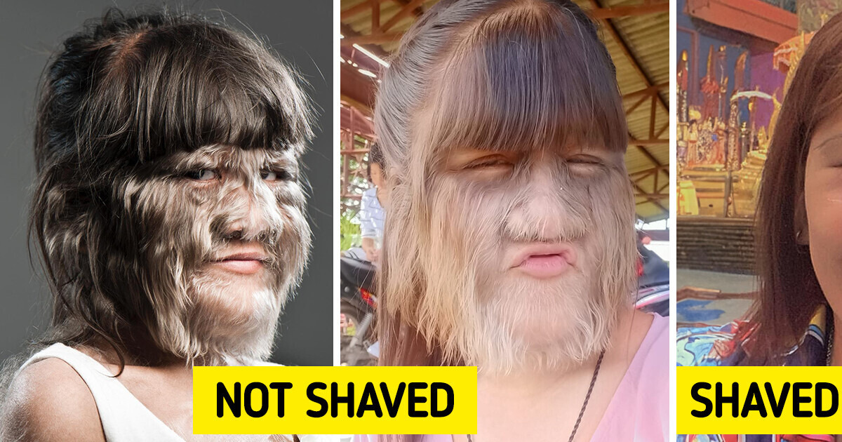 The Worlds Hairiest Girl Grew Up And Decided To Astonish Everyone With Her New Look Now Ive