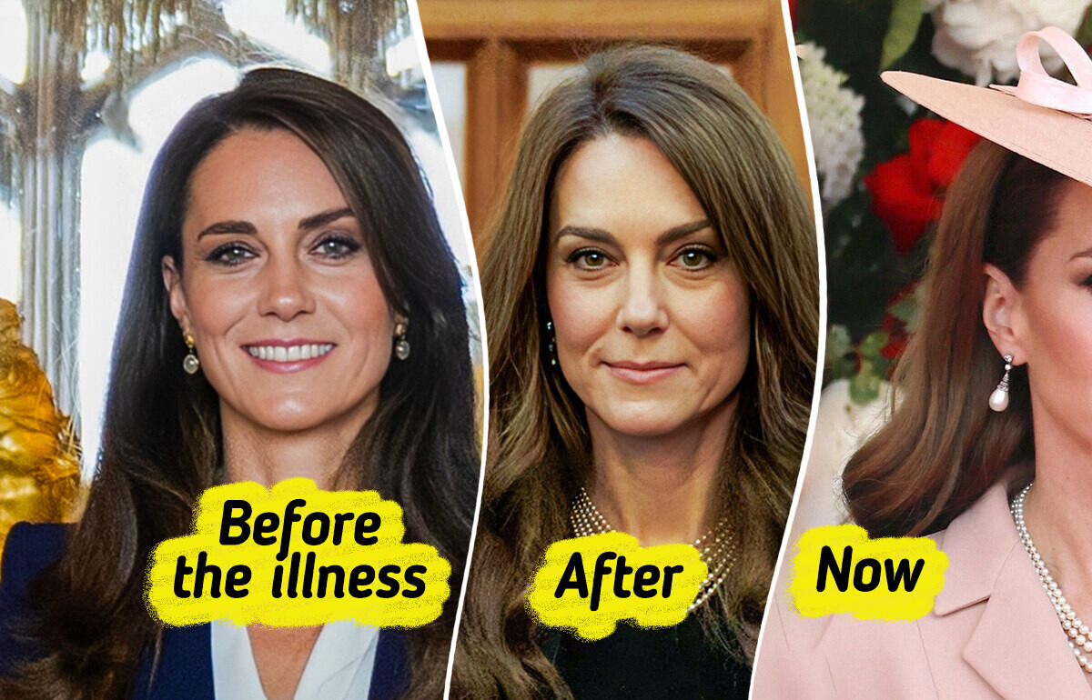 Kate Middleton Speaks Out About Healing Journey — Her Look Has Everyone ...