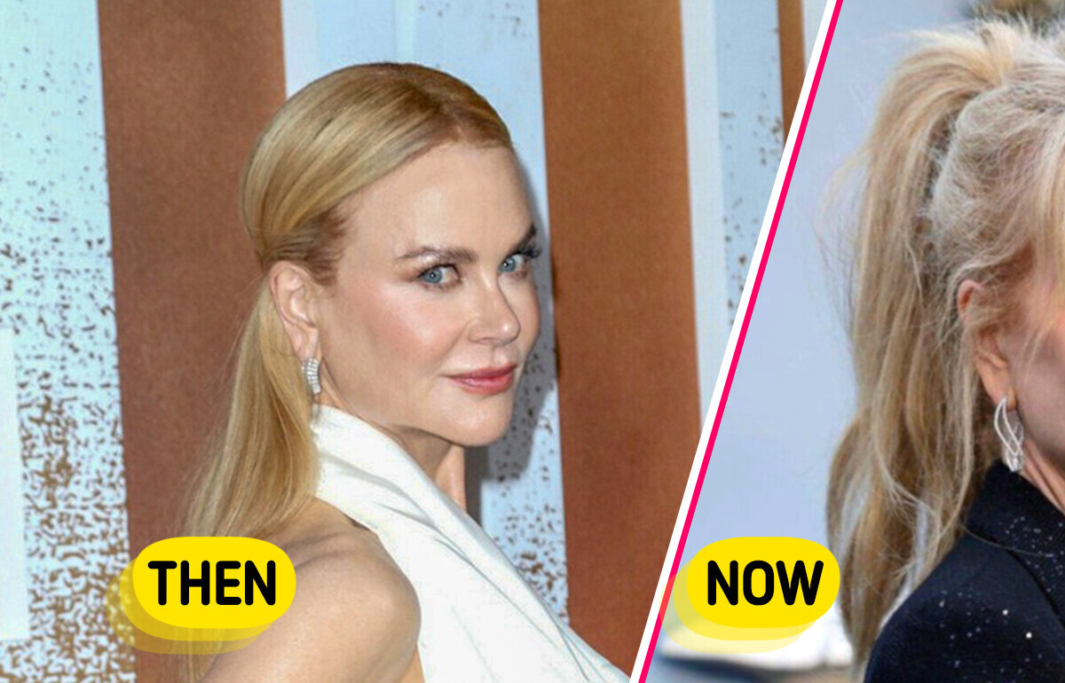 Nicole Kidman Creates Buzz with New Look — People Spot Facelift ...